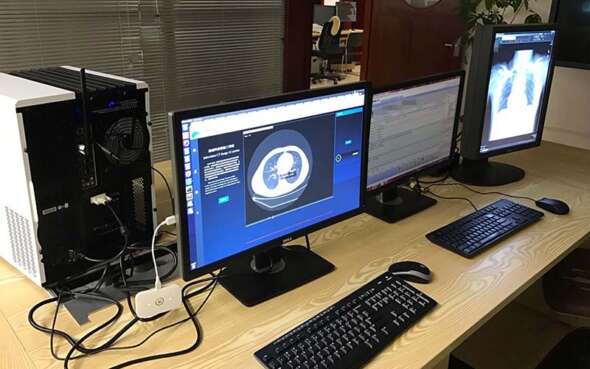 Infervision, a Chinese start-up uses AI to detect early signs of lung ...